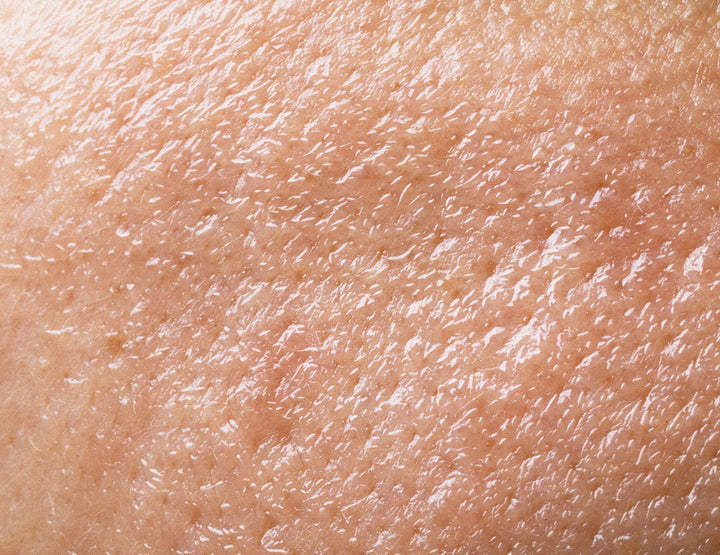 Oily Skin Type - Everything You Need To Know – Prequel