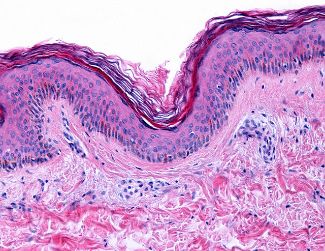 What To Know About Adenosine In Skincare- Benefits & Uses – Prequel